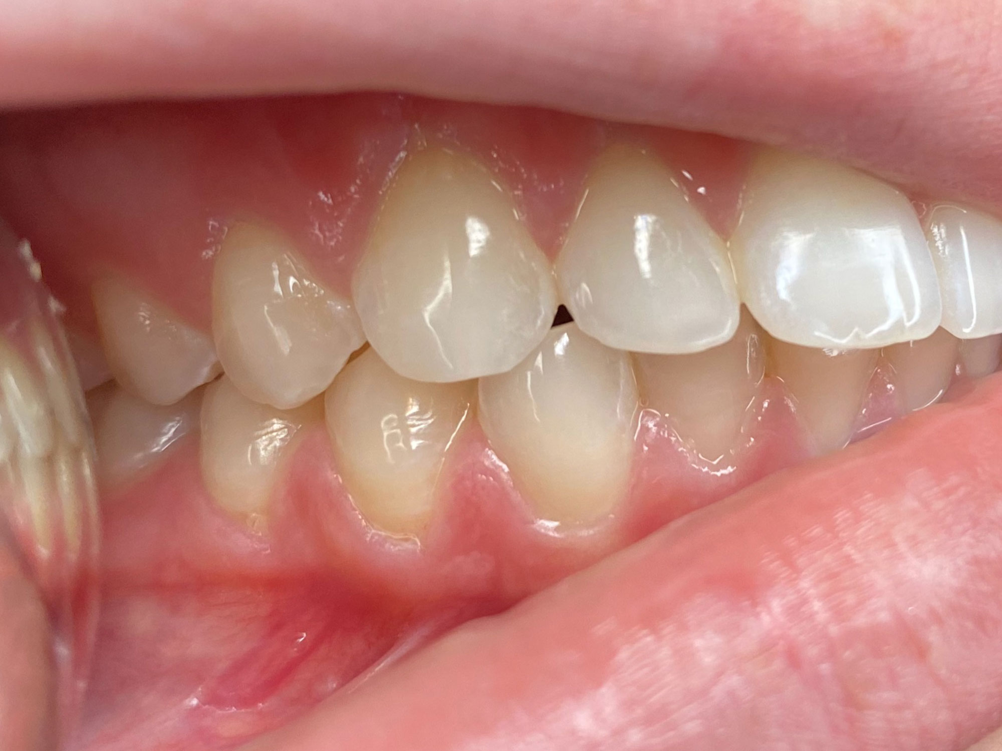Virtual Visits - Bordentown Braces