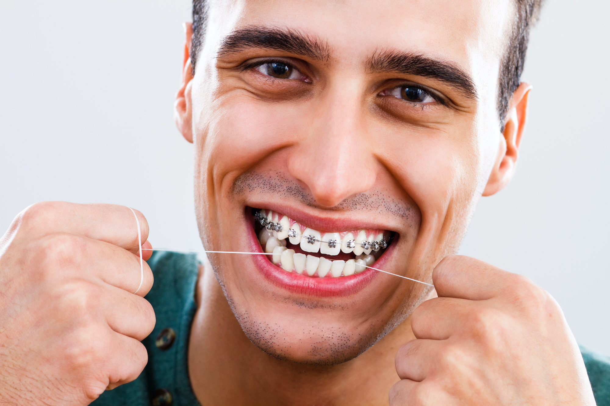 The Ultimate Braces Color Chooser Guide - Bordentown Braces
